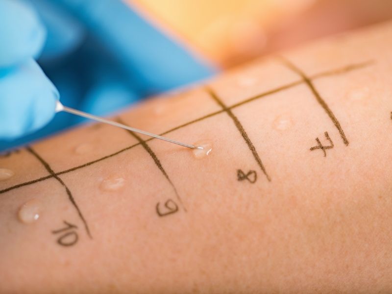 Behçet Hastalığı Testi - Ankara Göz Hastalıkları Uzmanı ve Üveit