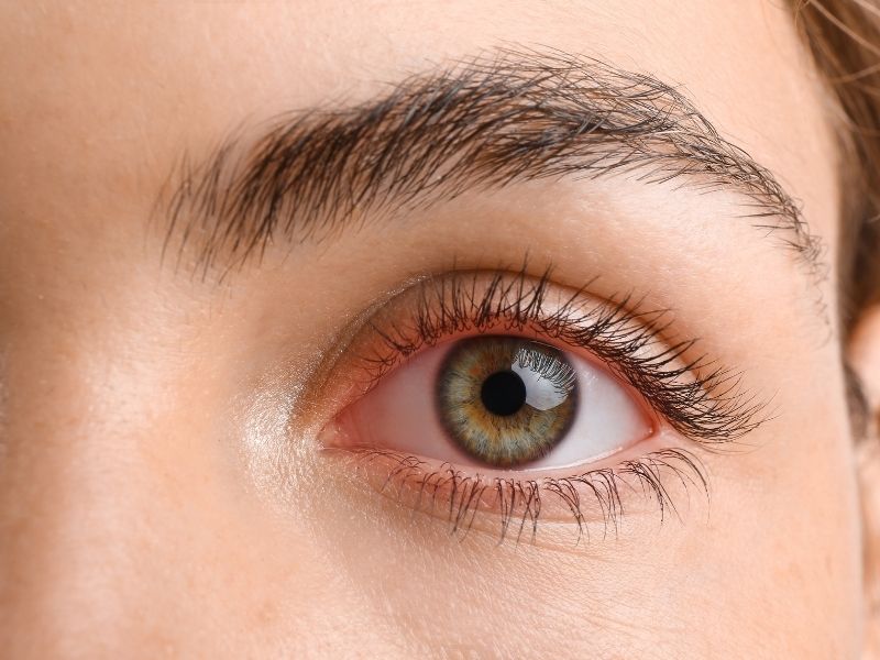 Üveit Tedavisi - Ankara Göz Hastalıkları Uzmanı ve Üveit